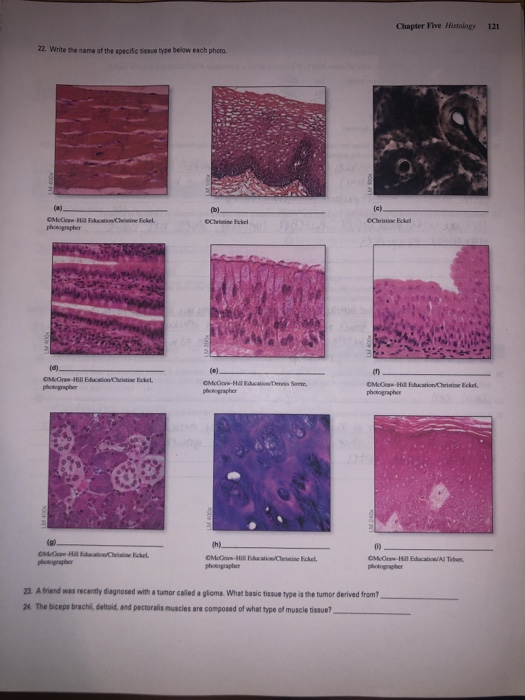 22. Write the name of the specific tissue type below | Chegg.com