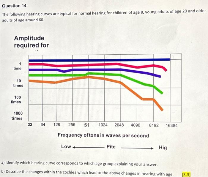 Solved The following hearing curves are typical for normal | Chegg.com