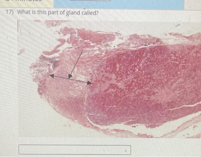 Solved 17) What is this part of gland called? | Chegg.com
