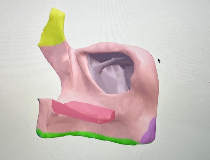 Select the zygomatic process | Chegg.com