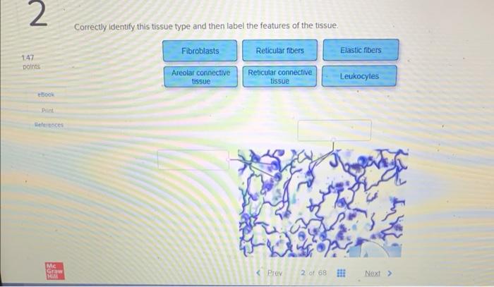 Solved Correctly identify this tissue type and then label | Chegg.com Solved Correctly identify this tissue type and then label | Chegg.com