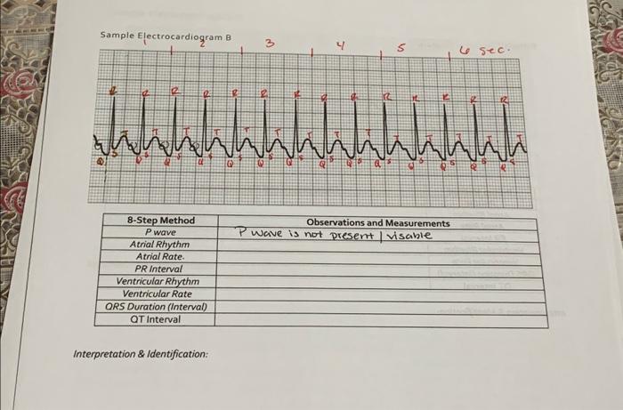 Solved Interpretation \& Identification: Interpretation \& | Chegg.com