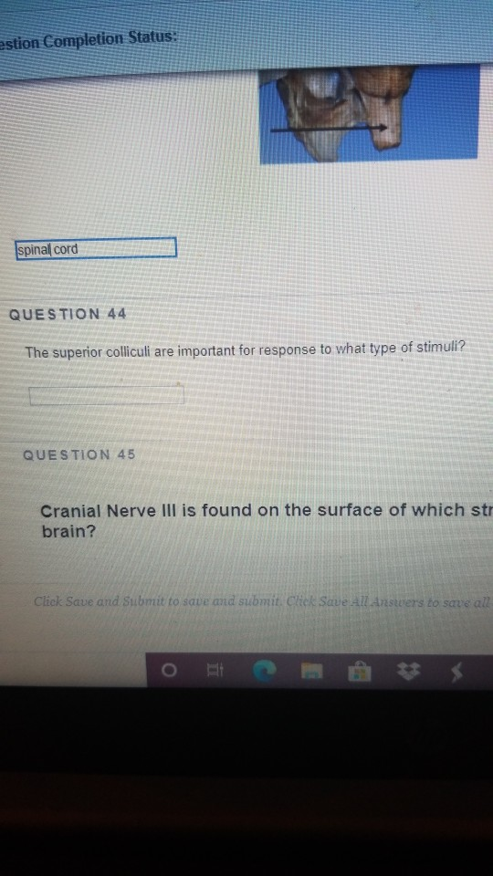 Solved estion Completion Status: spinal cord QUESTION 44 The | Chegg.com