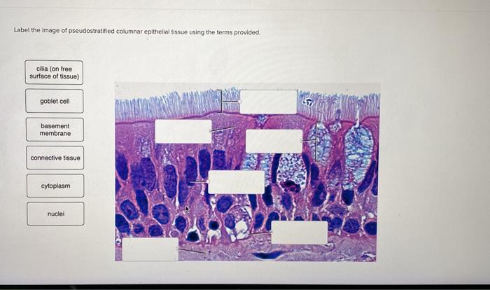 Solved Label the image of pseudostratified columnar | Chegg.com