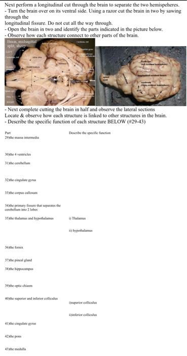 Next perform a longitudinal cut through the brain to | Chegg.com