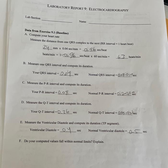 Solved LABORATORY REPORT 9: ELECTROCARDIOGRAPHY Lab Section | Chegg.com