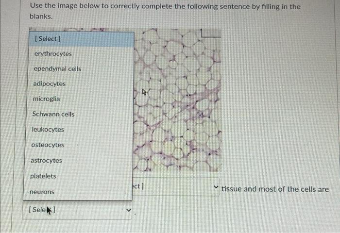 Solved Use the image below to correctly complete the | Chegg.com