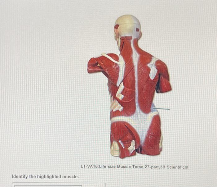 Solved Identify the highlighted muscle. | Chegg.com
