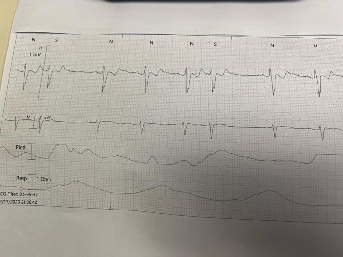 Solved Pleth Resp 10hm | Chegg.com