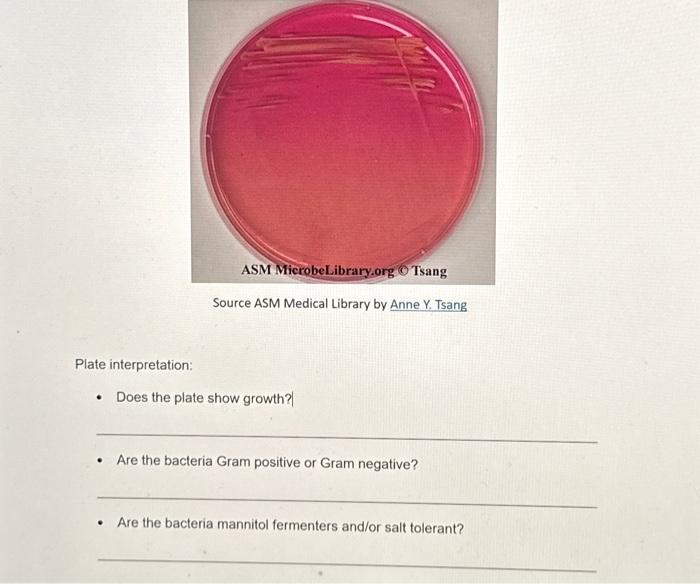 Solved Source ASM Medical Library by Anne Y. Tsang Plate | Chegg.com