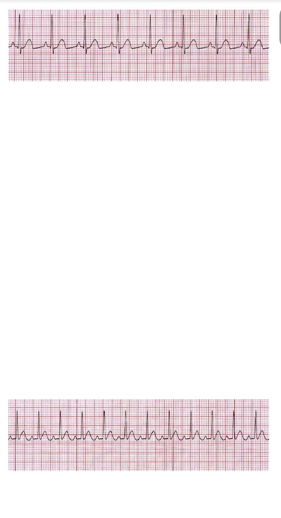 Solved Instructions: Step 1: Identify each of the three ECG | Chegg.com