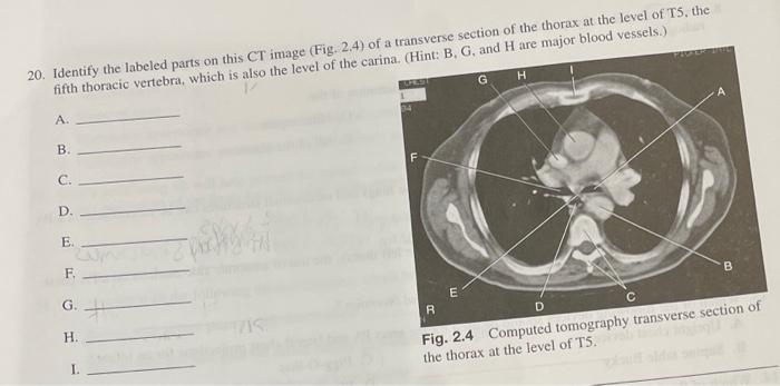 Solved G H 20. Identify the labeled parts on this CT image | Chegg.com