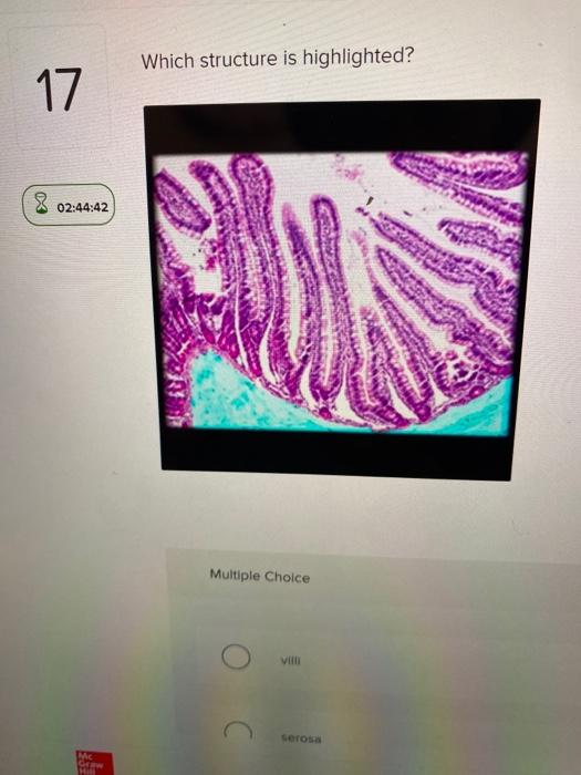 Solved Which structure is highlighted? 17 02:44:42 Multiple | Chegg.com