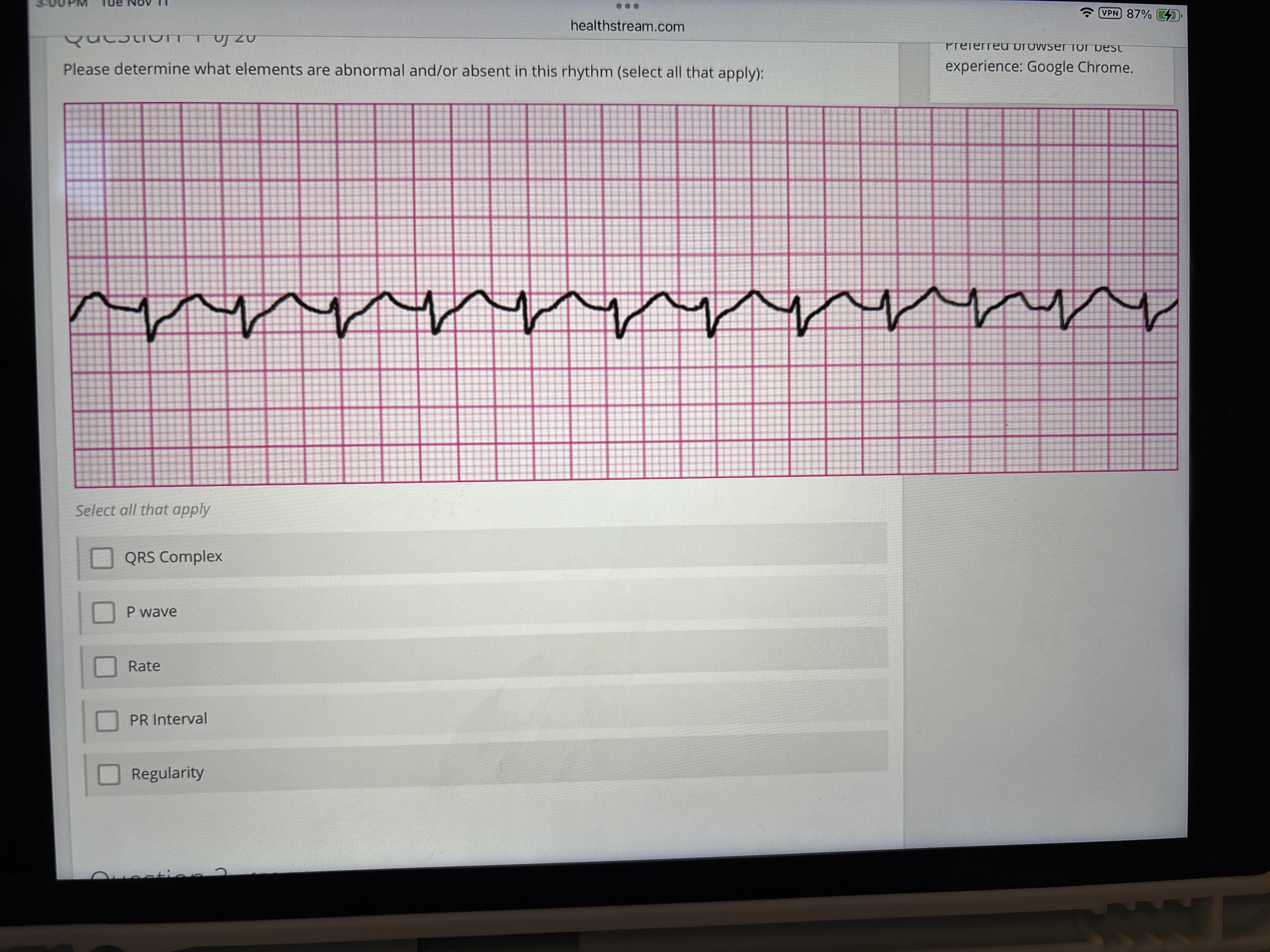 Solved Hca ekg \( 87 \% \)healthstream.comPlease determine | Chegg.com