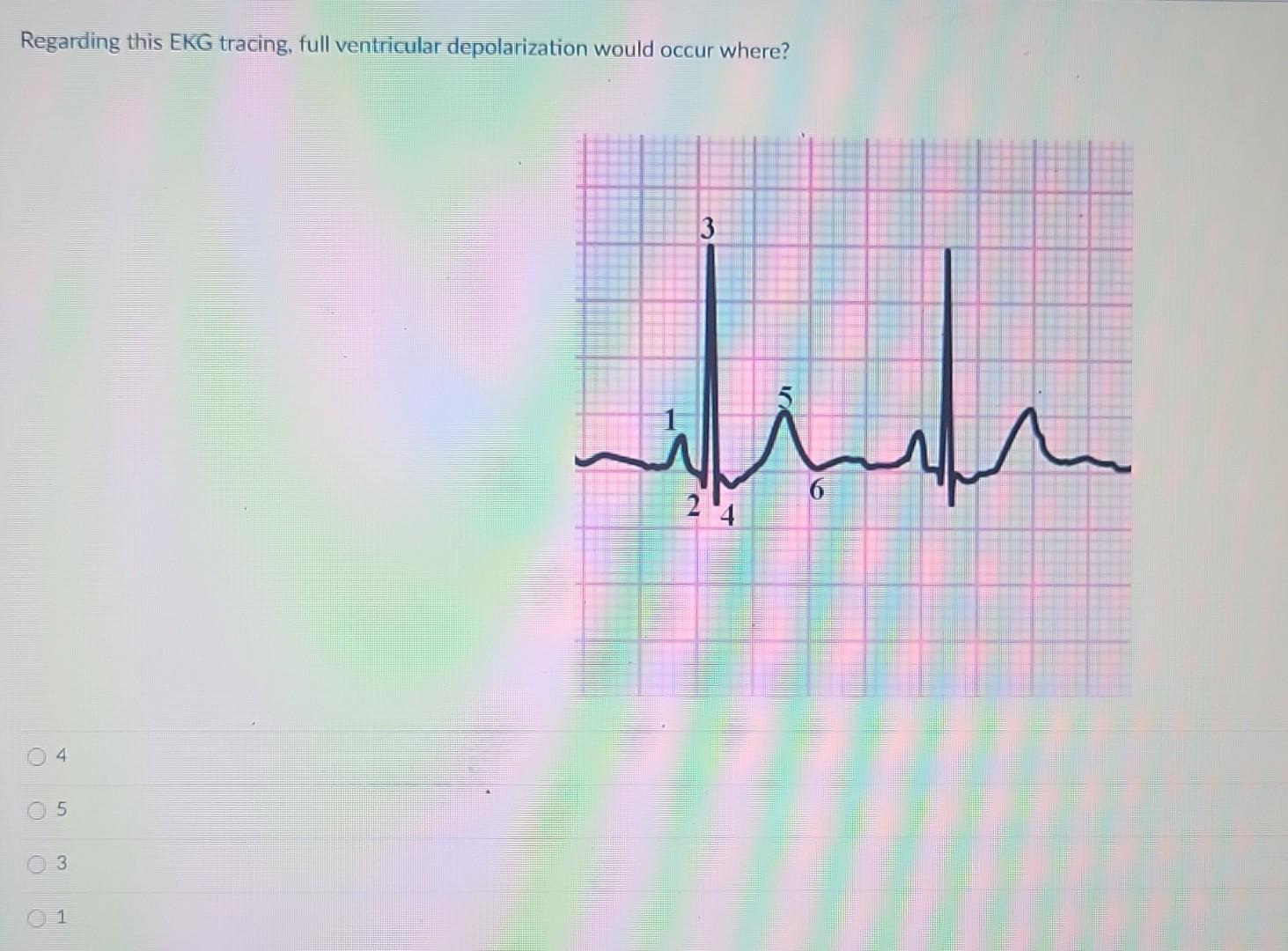Solved Regarding this EKG tracing, full ventricular | Chegg.com