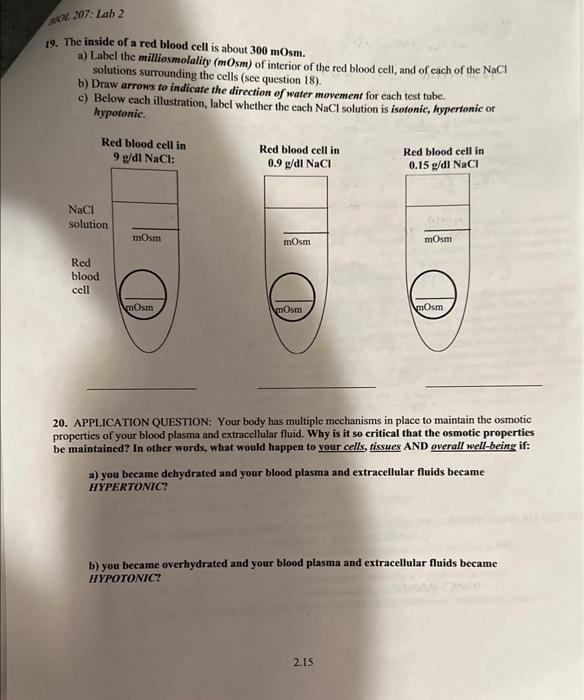 Solved 19. The inside of a red blood cell is about 300mOsm. | Chegg.com