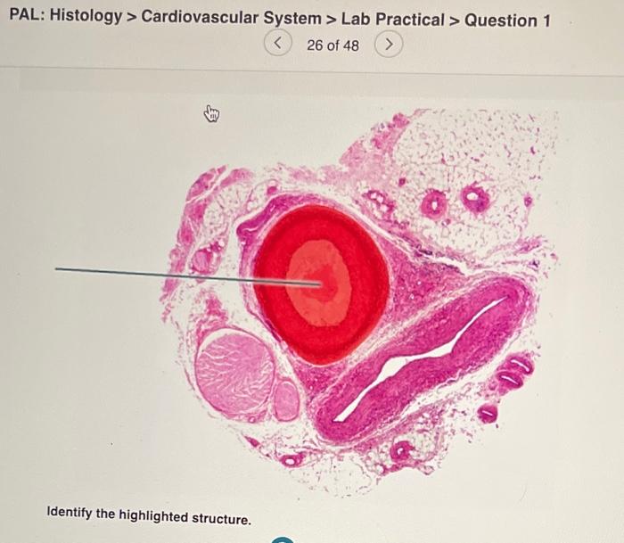 Solved PAL: Histology > Cardiovascular System > Lab | Chegg.com Solved PAL: Histology > Cardiovascular System > Lab | Chegg.com