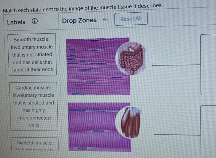 Match each statement to the image of the muscle | Chegg.com