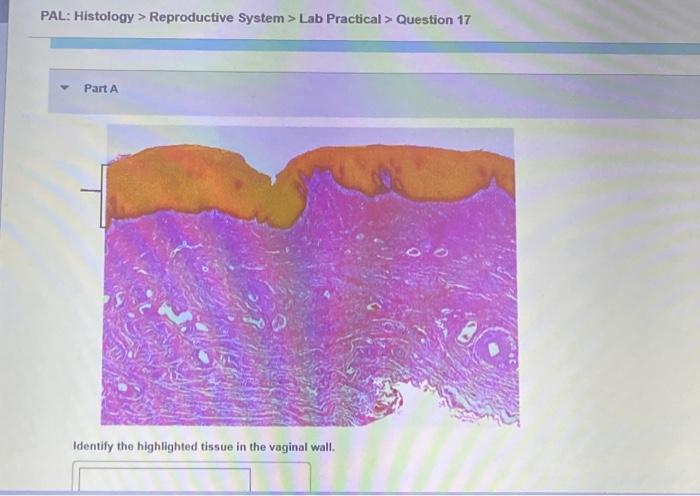 Solved PAL: Histology > Cardiovascular System > Lab | Chegg.com