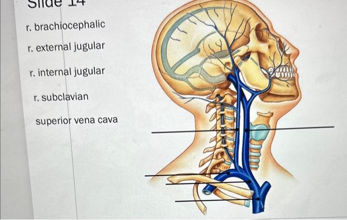 r. brachiocephalic r. external jugular r. internal | Chegg.com