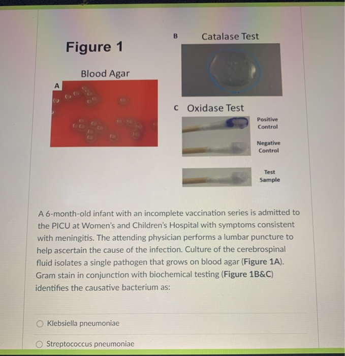 Solved B Catalase Test Figure 1 Blood Agar А C Oxidase Test | Chegg.com