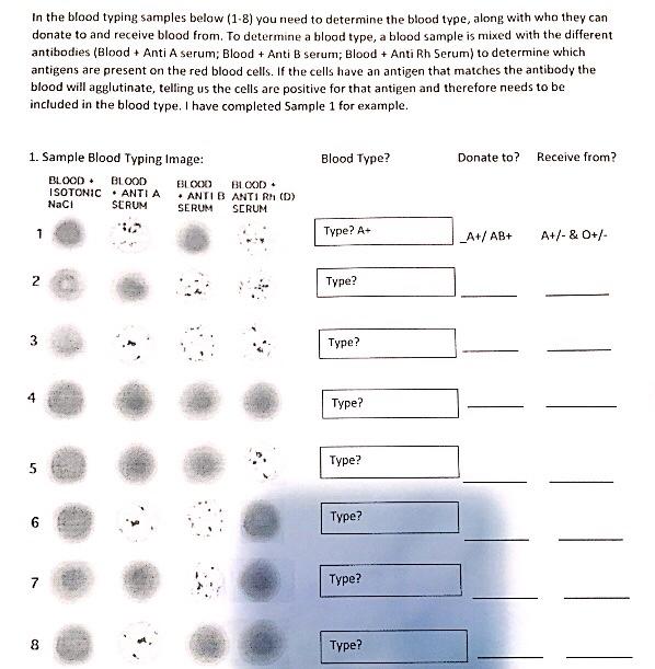 Solved In the blood typing samples below (1-8) you need to | Chegg.com