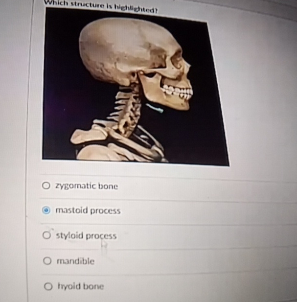 Solved Which structure is highlighted?zygomatic bonemastoid | Chegg.com
