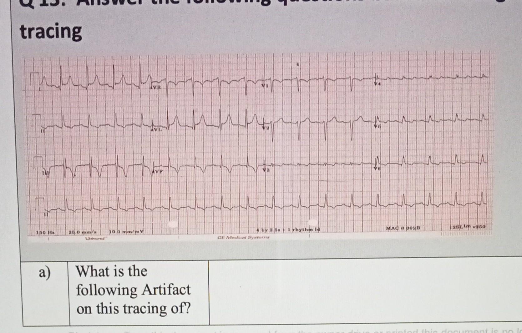 Solved tracing inthrotuthim 150 1Kz a) What is the following | Chegg.com