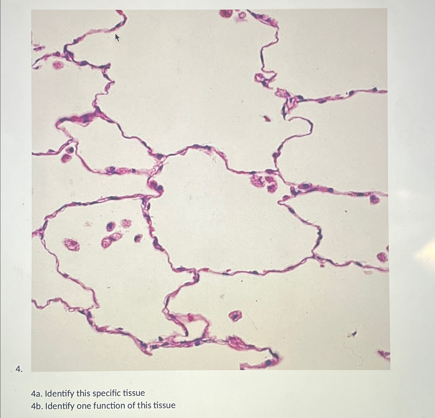 Solved 44a. ﻿Identify this specific tissue4b. ﻿Identify one | Chegg.com