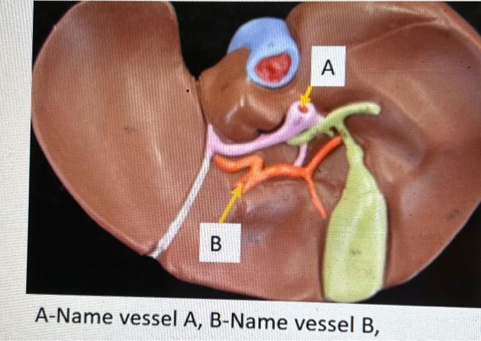 Solved A-ivame vessel A, B-Name vessel B, | Chegg.com