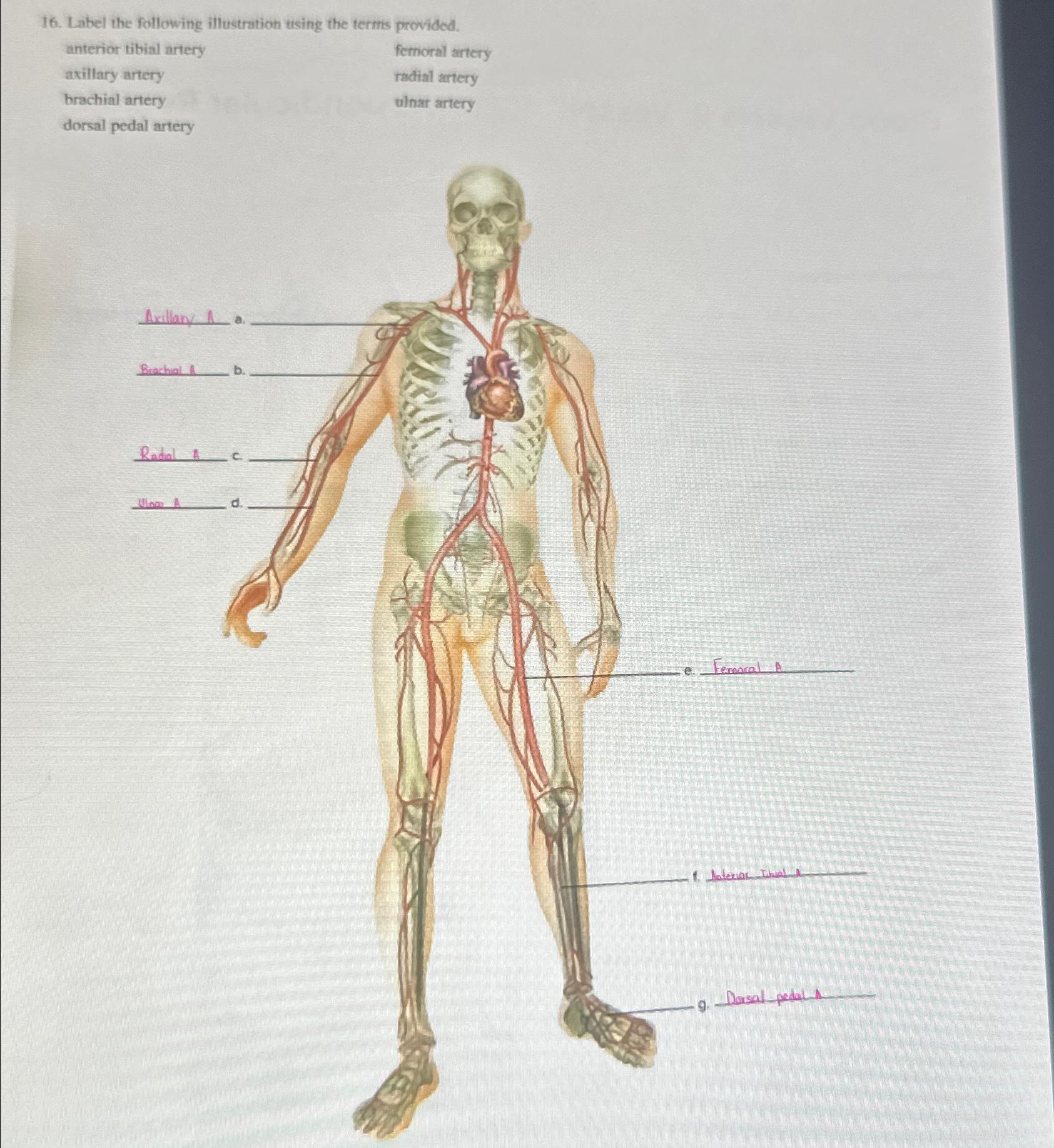 Solved Label the following illustration using the terms | Chegg.com