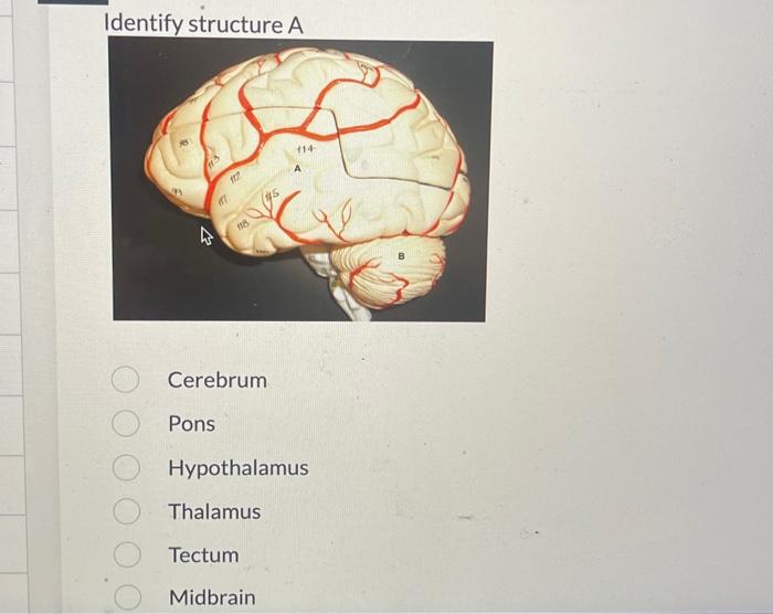 Solved Identify structure A Cerebrum Pons Hypothalamus | Chegg.com