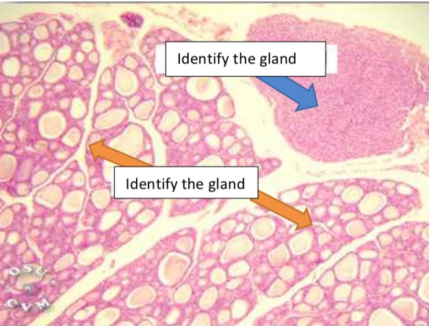 Solved Identify the gland Identify the gland | Chegg.com