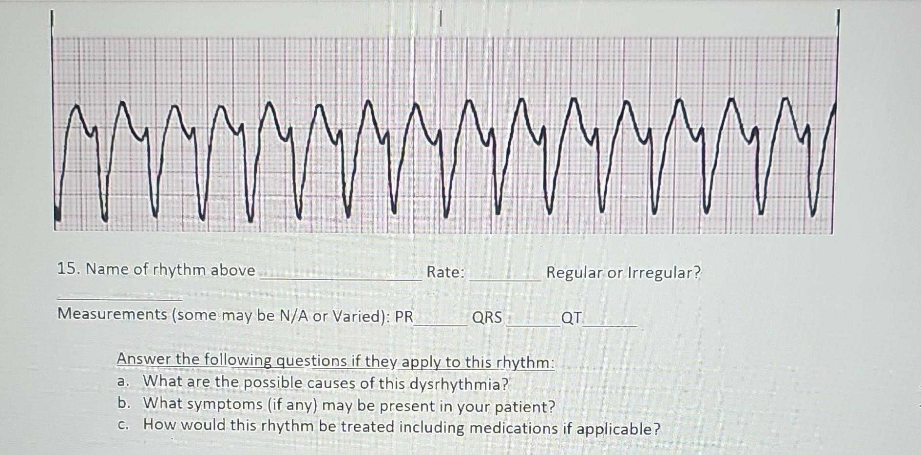 Solved 7. Name the rhythm above Rate: Regular or Irregular? | Chegg.com