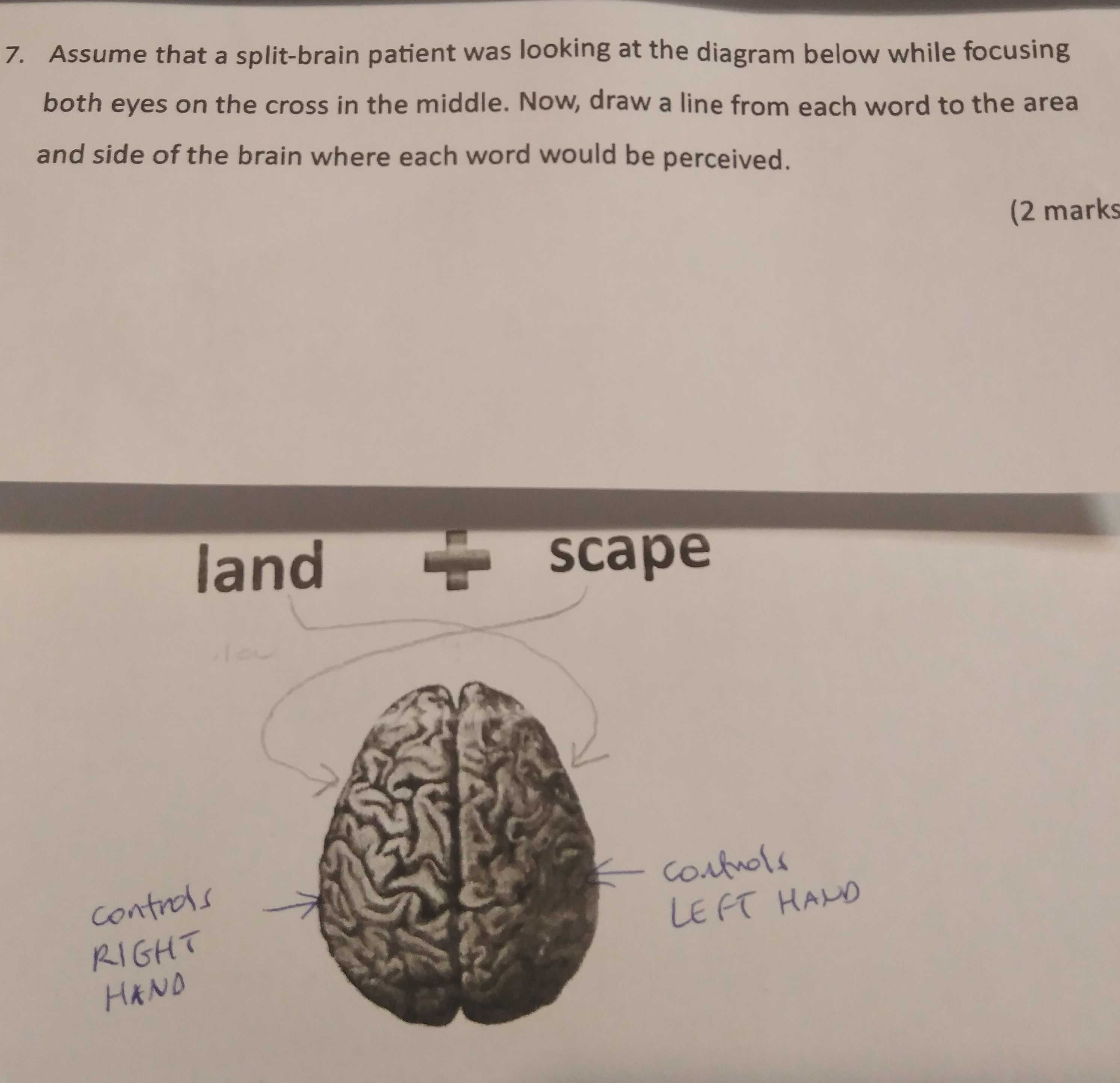 Solved Assume that a split-brain patient was looking at the | Chegg.com