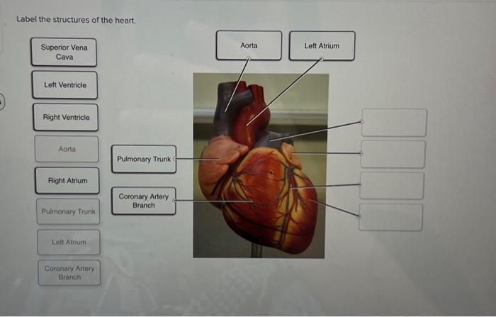 Solved Label the structures of the heart. Superior Vena Cava | Chegg.com
