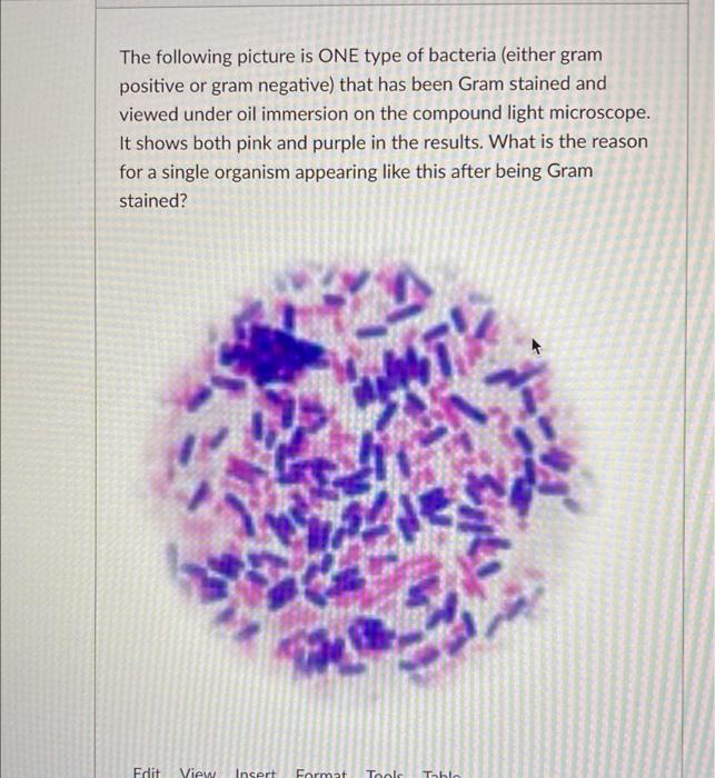 Gram Positive Vs Gram Negative Microscope Gram Positive Vs Gram Negative Microscope