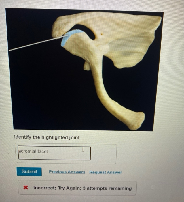 Solved Identify the highlighted joint. acromial facet Submit | Chegg.com
