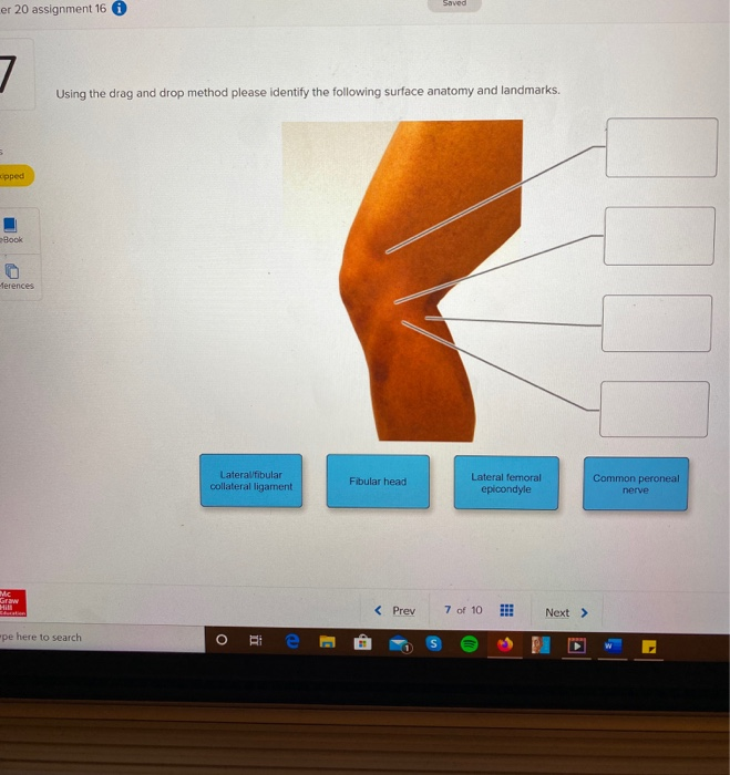 Solved Using the drag and drop method please identify the | Chegg.com
