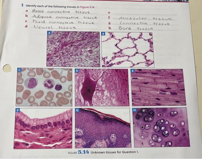 Solved 1 Identify each of the following tissues in Figure | Chegg.com