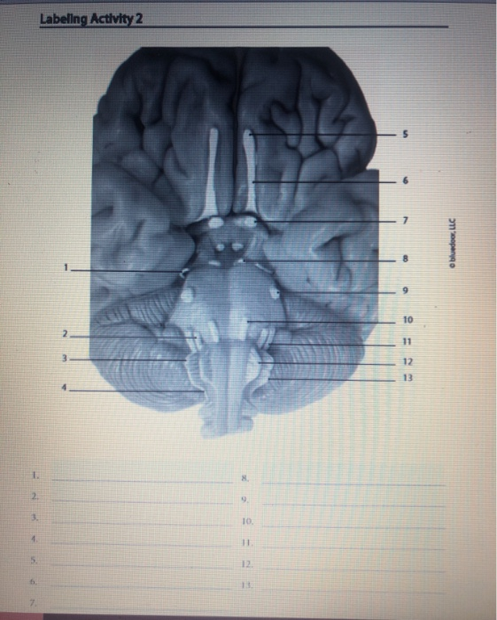 Solved Labeling Activity 2 = P- | Chegg.com