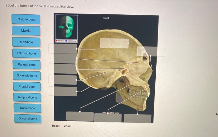 Solved Label The Bones Of The Skull In Midsagittal View