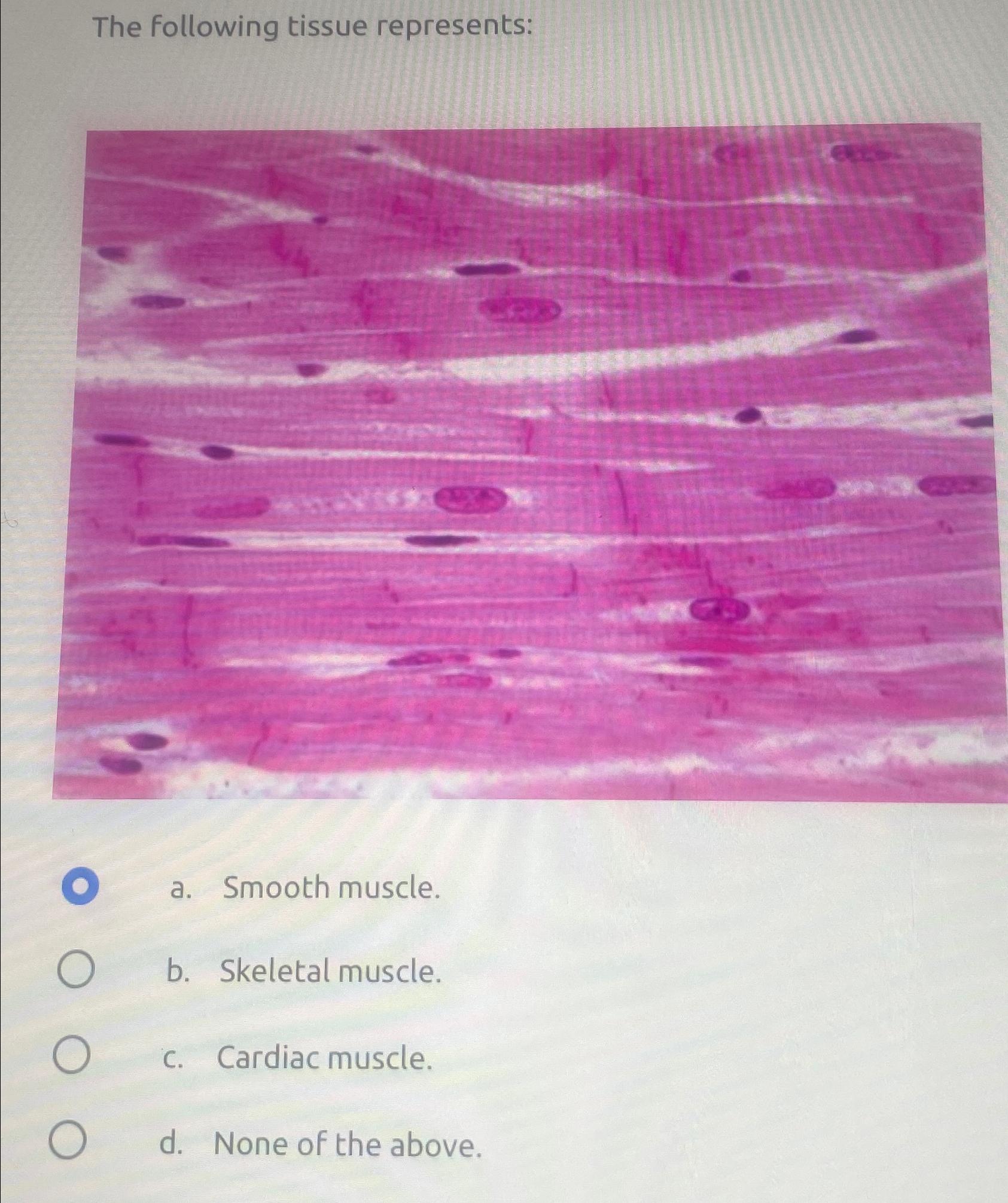 Solved The following tissue represents:a. ﻿Smooth muscle.b. | Chegg.com