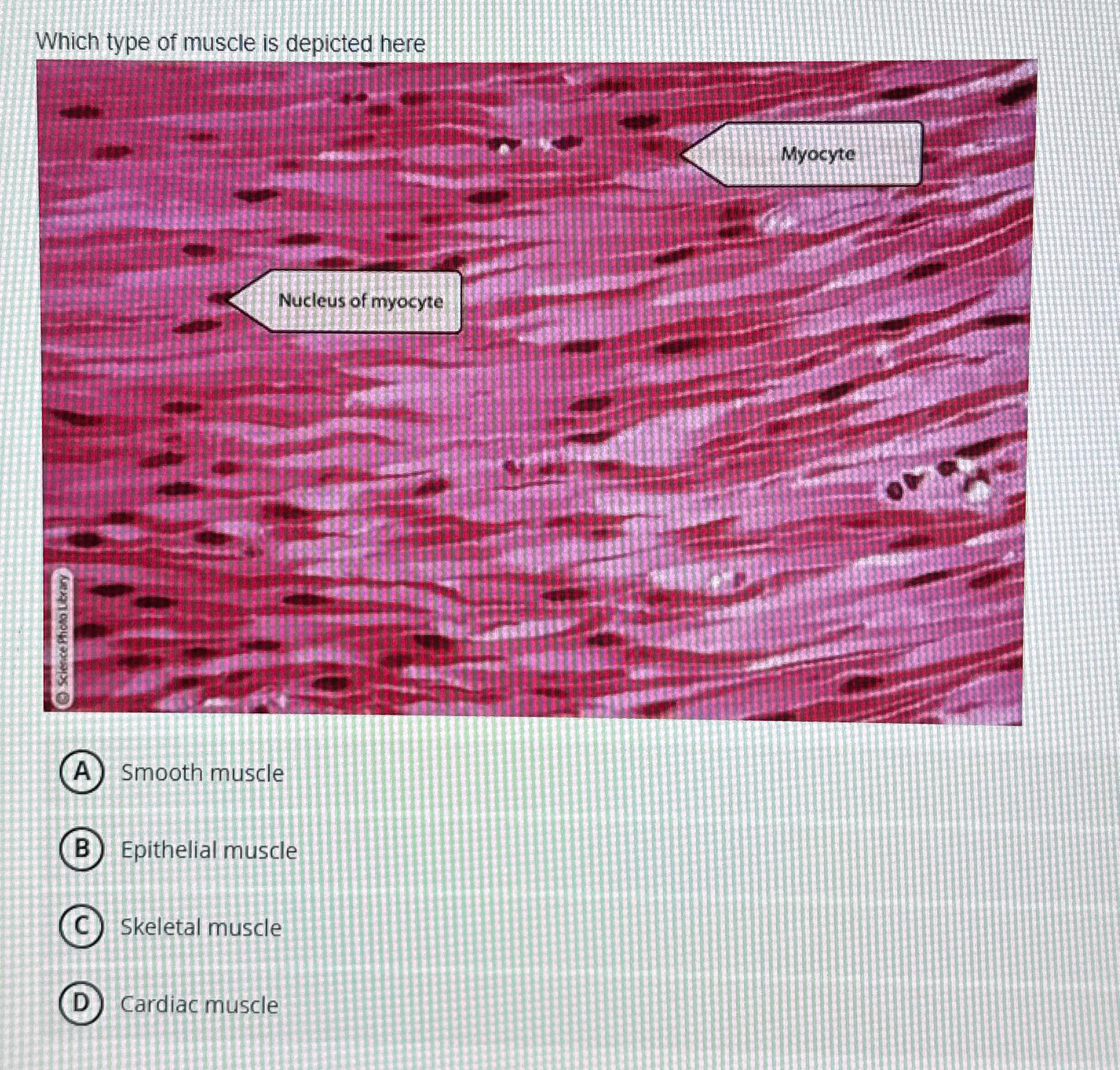 Solved Which type of muscle is depicted hereSmooth | Chegg.com