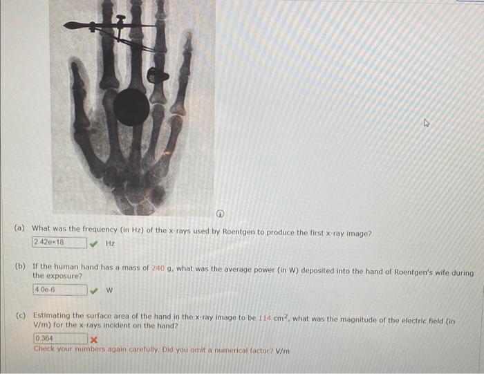 Solved The first ever x-ray of the human body was that of | Chegg.com