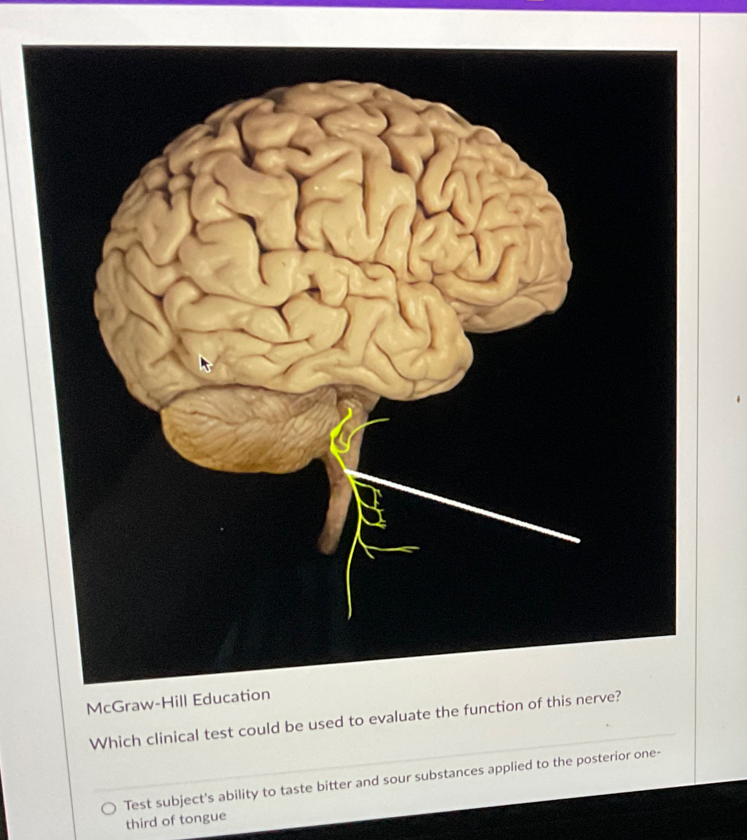 Solved McGraw-Hill EducationWhich clinical test could be | Chegg.com