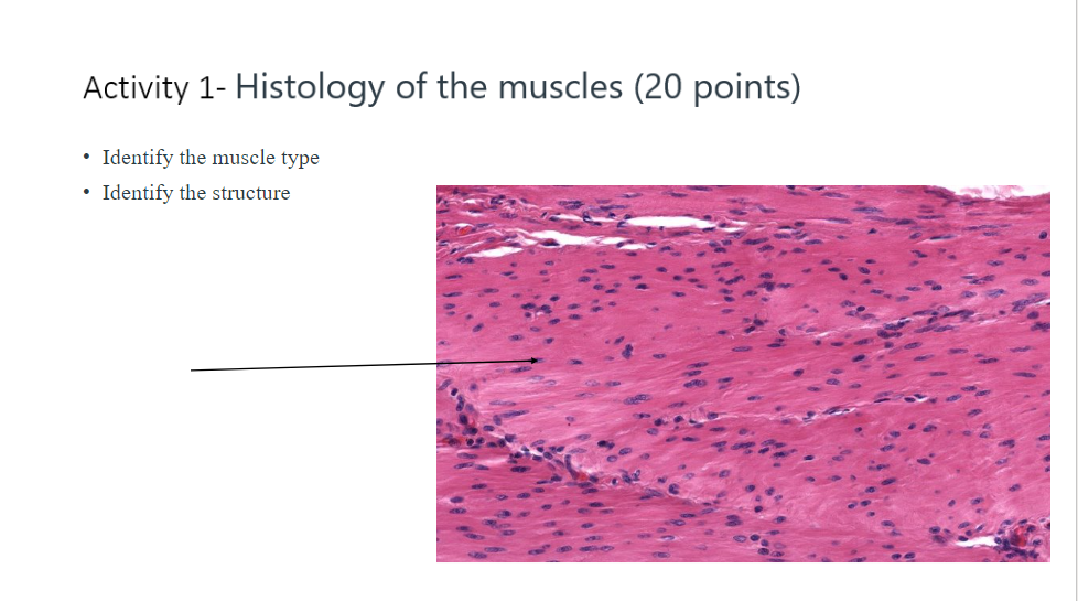 Solved Identify the muscle labeled "1."Identify the muscle | Chegg.com