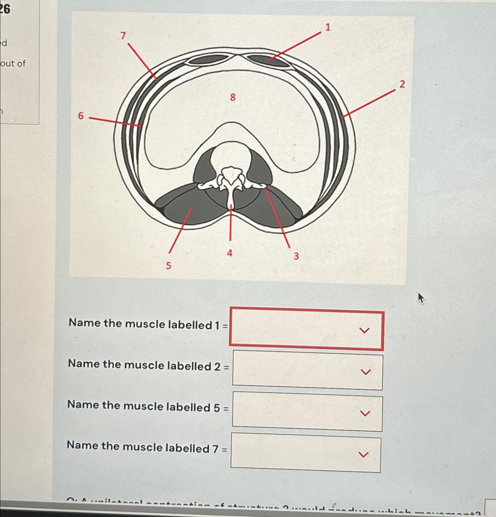 Solved 26Name the muscle labelled 1=Name the muscle labelled | Chegg.com