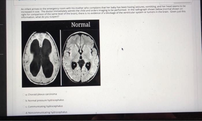 Solved 1 The subdural space is between the: A. arachnoid | Chegg.com