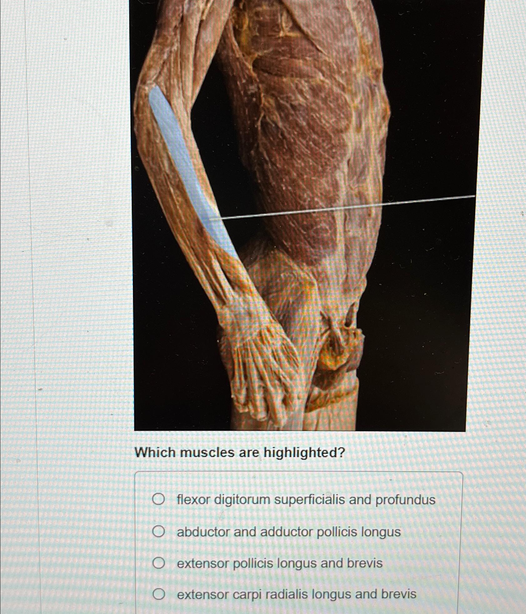 Solved Which muscles are highlighted?flexor digitorum | Chegg.com